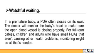 Patent ductus arteriosus in english | PPTX