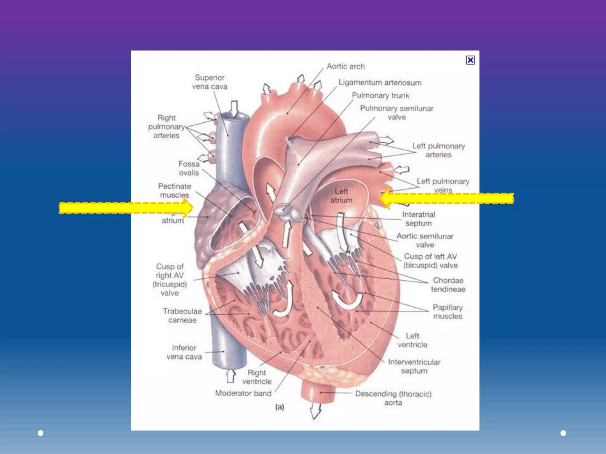 Congenital Heart Disease Pda And Aorta Coarctation Ppt