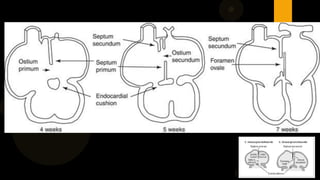 Patent foramen ovale vs atrial septal defect | PDF