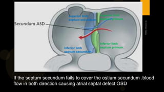 Patent foramen ovale vs atrial septal defect | PDF