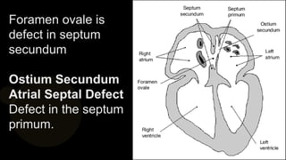 Patent foramen ovale vs atrial septal defect | PDF
