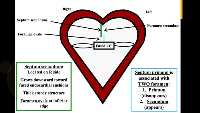 Patent foramen ovale vs atrial septal defect | PPT