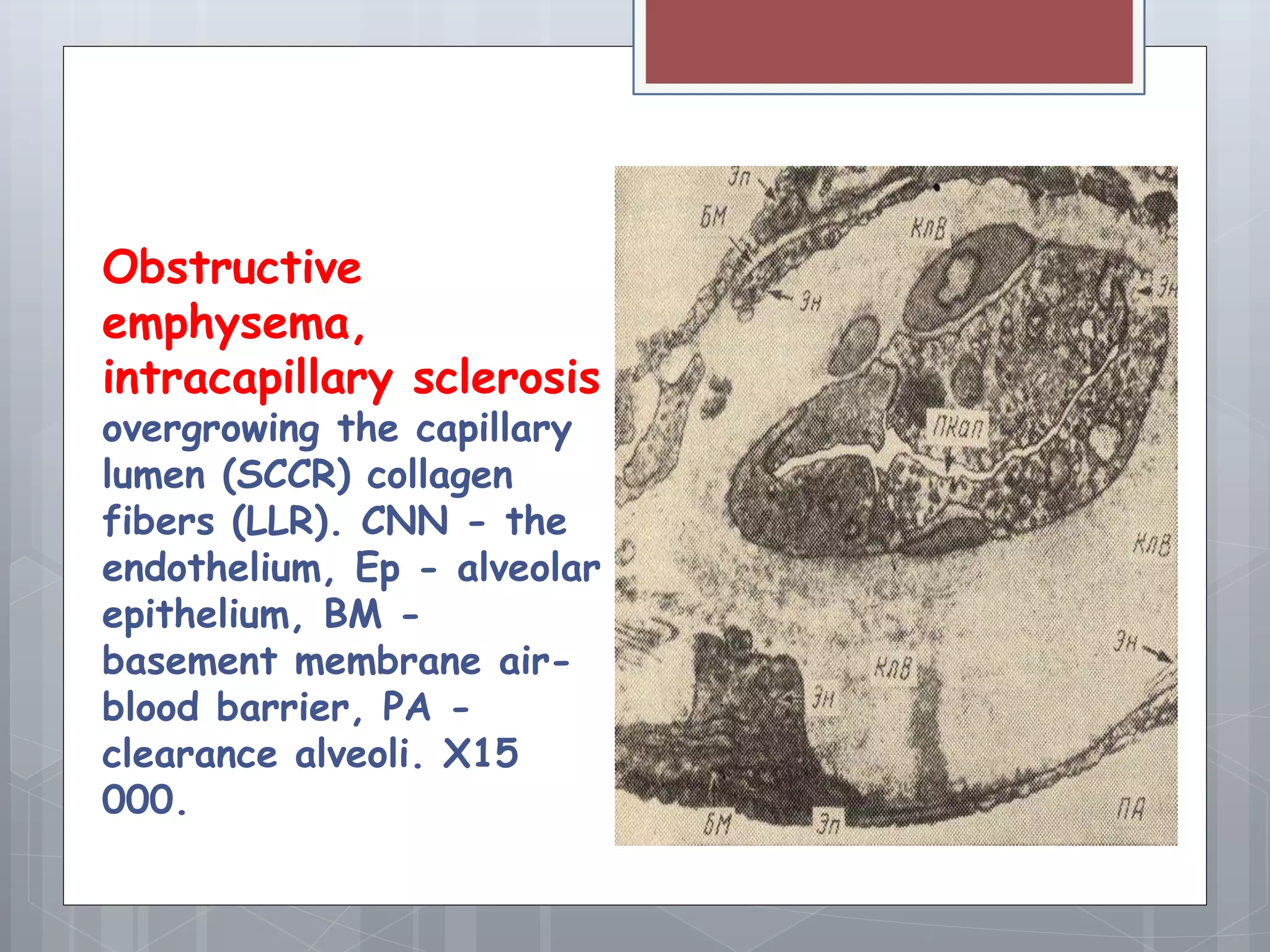 Pulmonary Emphysema. Pathomorphology, outcomes, complications | PPTX ...