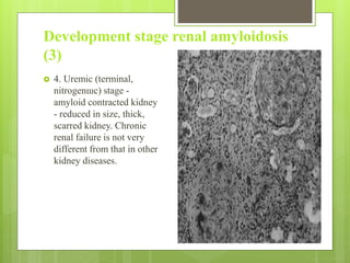 Amyloidosis of kidney. Morphological characteristics, outcomes ...