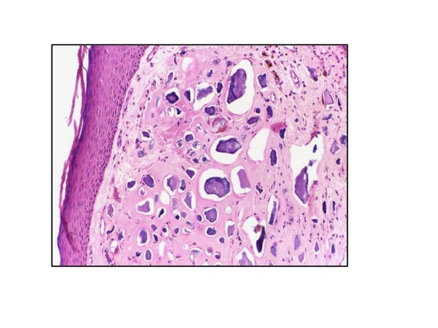 Path calcification for mbbs 2nd year pathology | PPTX | Bone and Joint ...