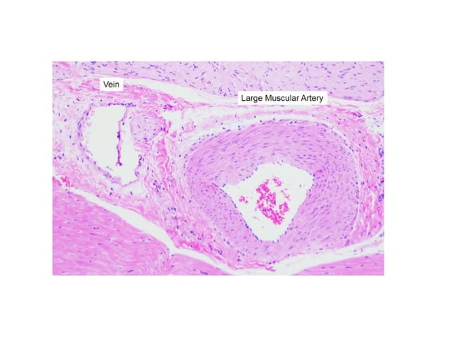 Path calcification for mbbs 2nd year pathology | PPT