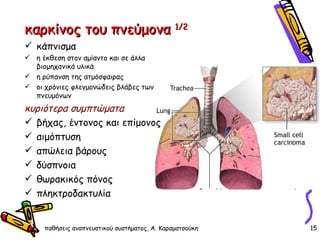 Παθήσεις αναπνευστικού_ Καραματσούκη | PPT