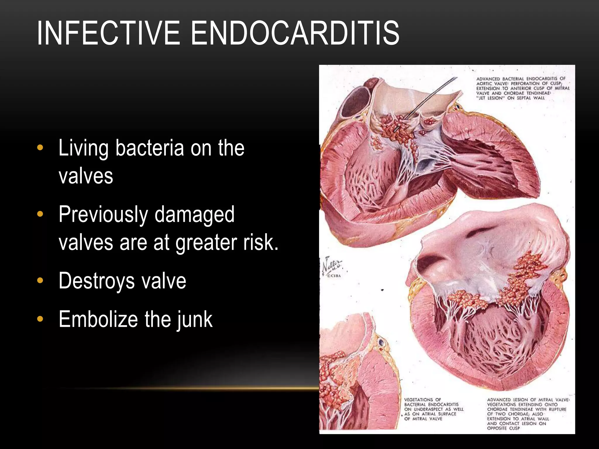 cardiac pathology | PPTX | Heart and Cardiovascular Diseases | Diseases ...