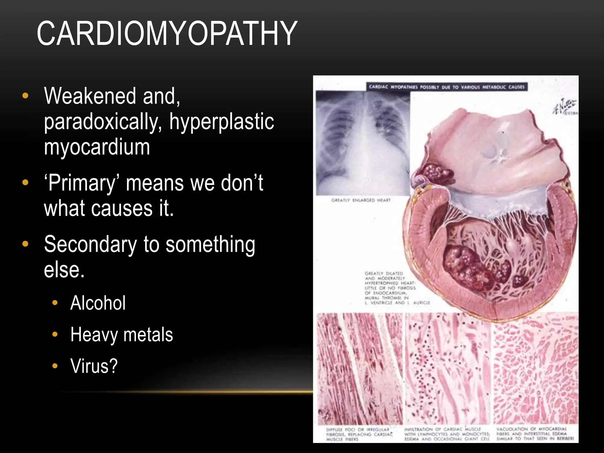 cardiac pathology | PPTX | Heart and Cardiovascular Diseases | Diseases ...
