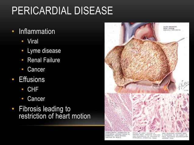 cardiac pathology | PPTX | Heart and Cardiovascular Diseases | Diseases ...