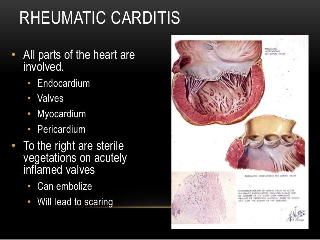 cardiac pathology