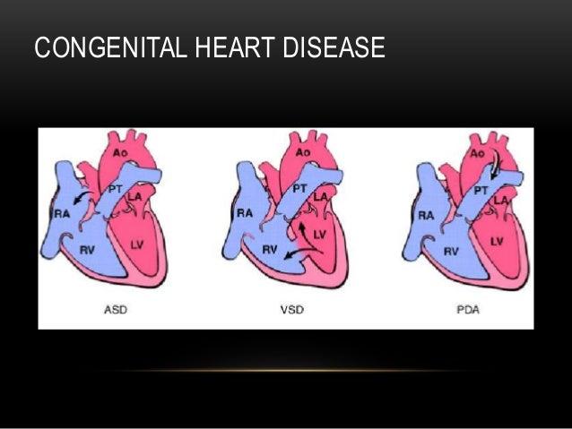 cardiac pathology