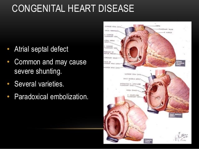 cardiac pathology