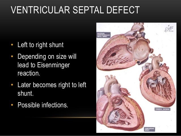 cardiac pathology