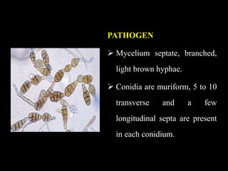 Diseases of crossandra | PPTX