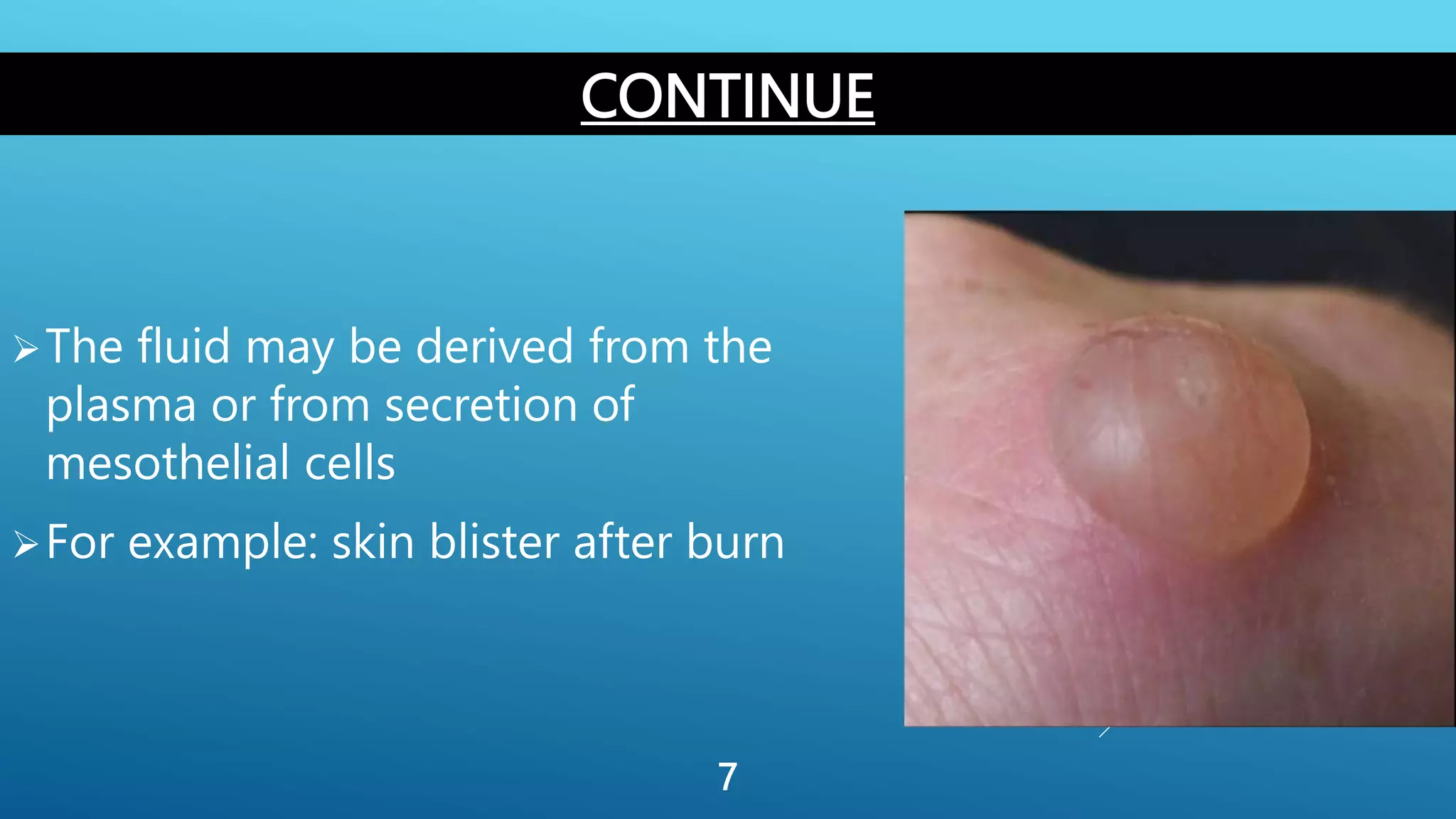 Morphological patterns and outcomes of acute inflammation | PPTX