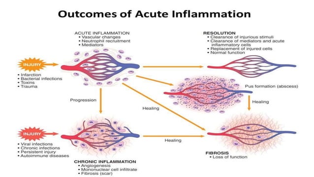 Morphological patterns and outcomes of acute inflammation | PPTX