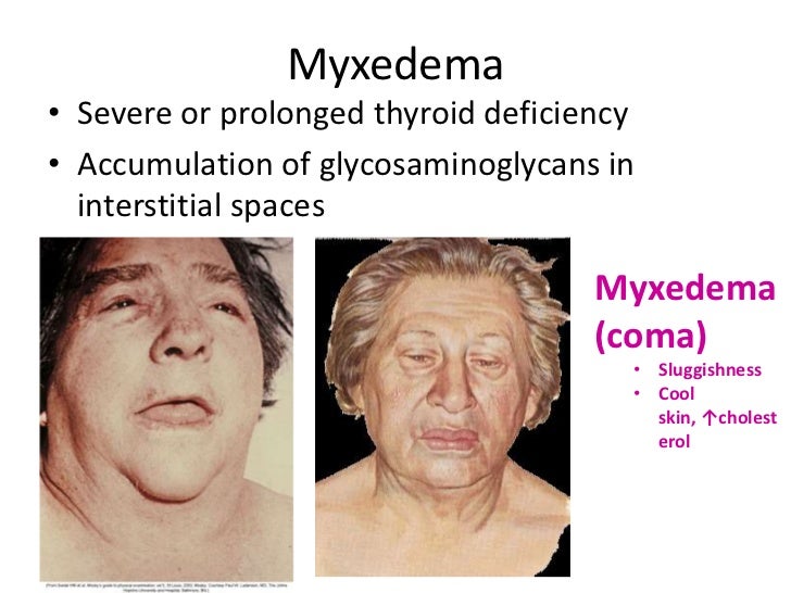 Patho2 chapter40 student1