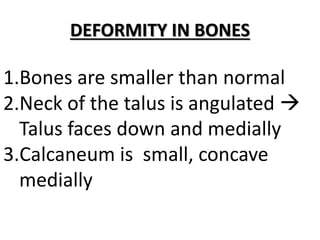 Pathoanatomy Of CTEV | PPTX