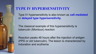 hypersensitivity | PPTX