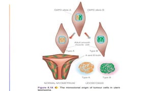 Pathogenesis of cancer | PPTX
