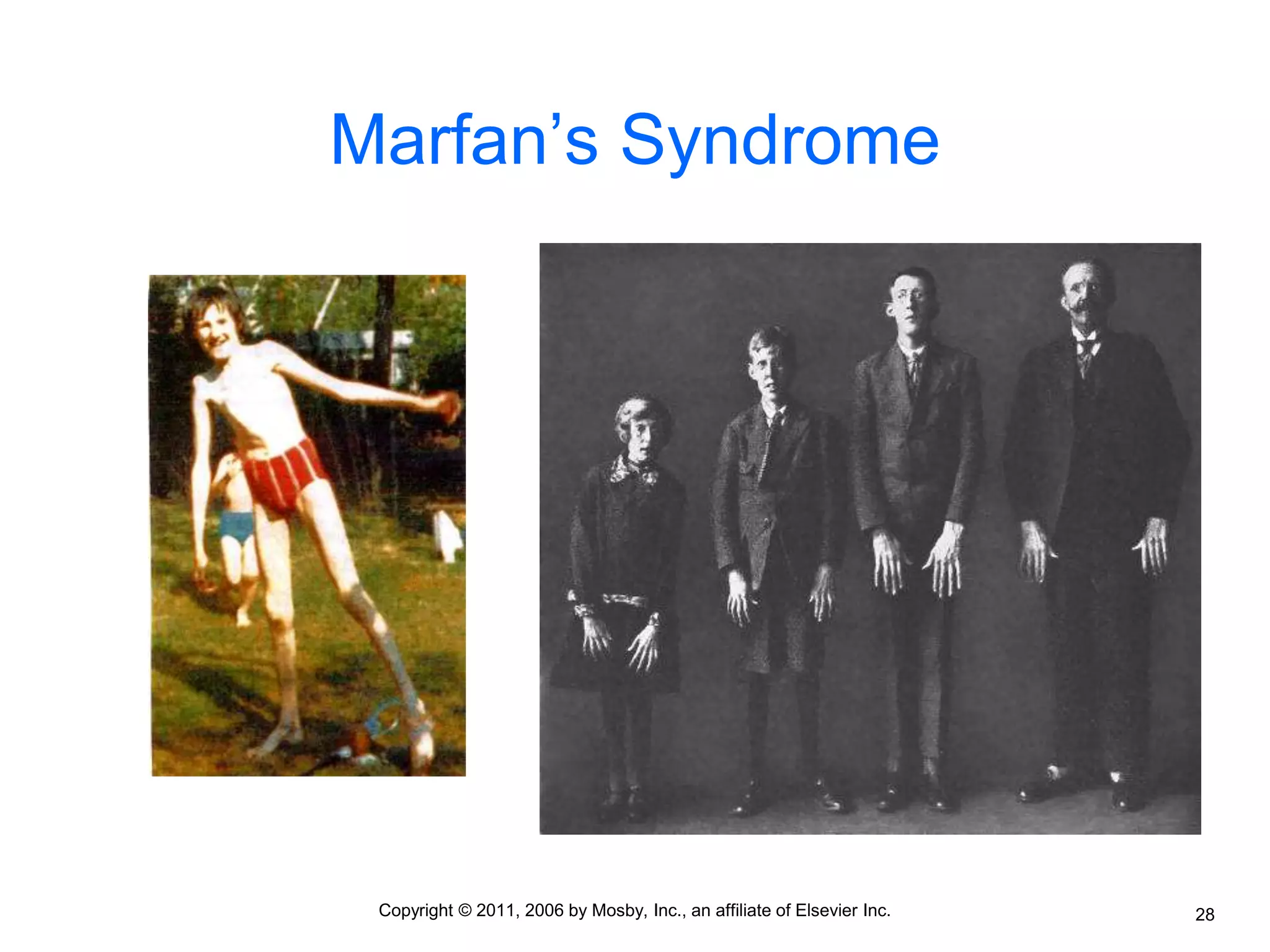 Patho ch21congenitalsum14 (1) | PPT