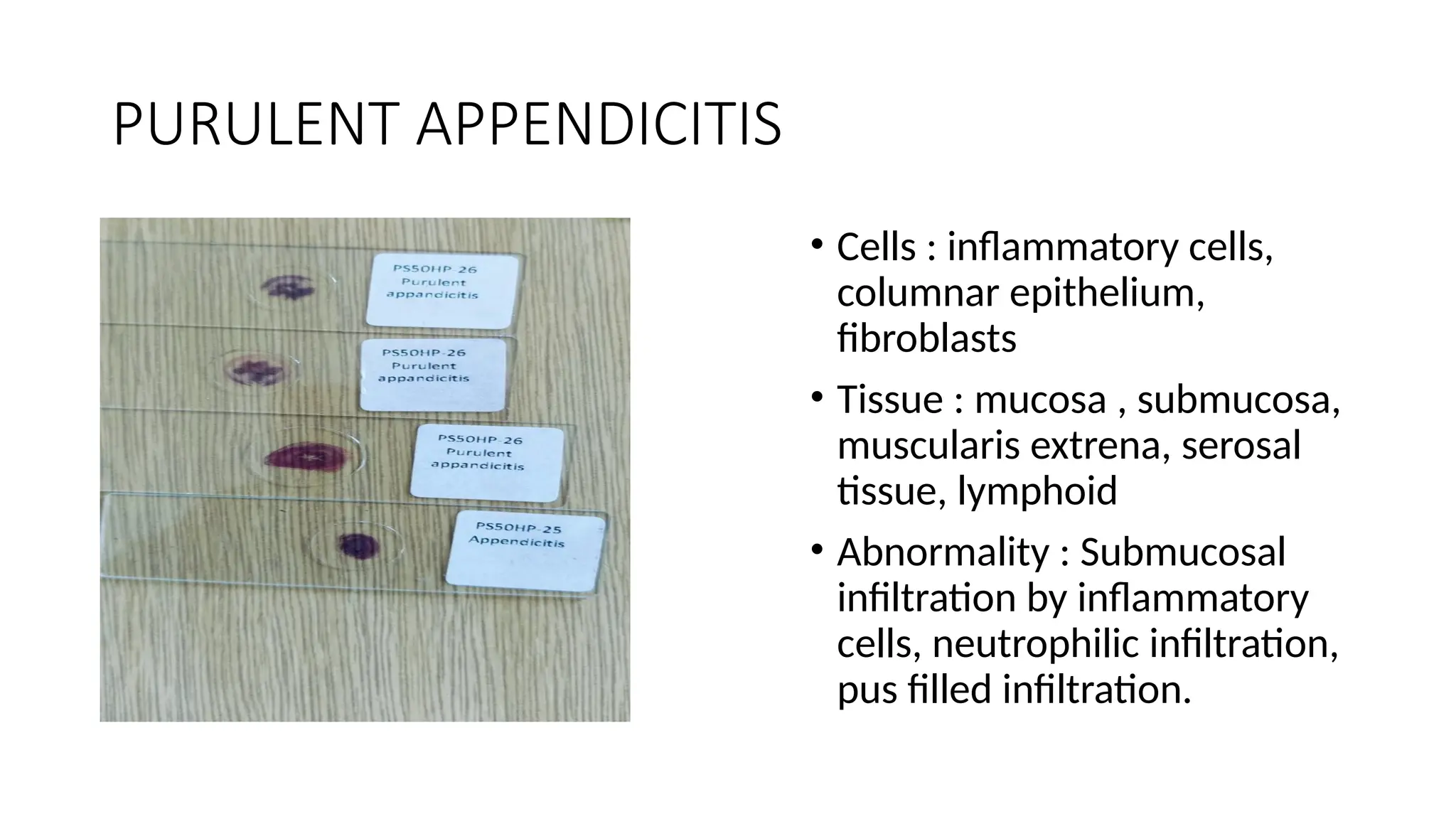 Pathology slides of histology of endometriosis | PPTX
