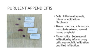 Pathology slides of histology of endometriosis | PPTX