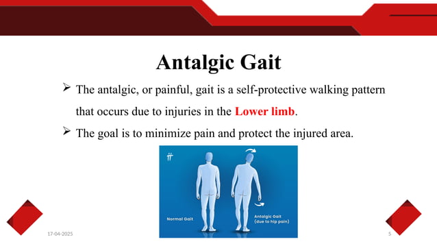 Pathological Gait, Micro teaching on pathological gait | PPT