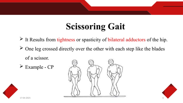 Pathological Gait, Micro teaching on pathological gait | PPT