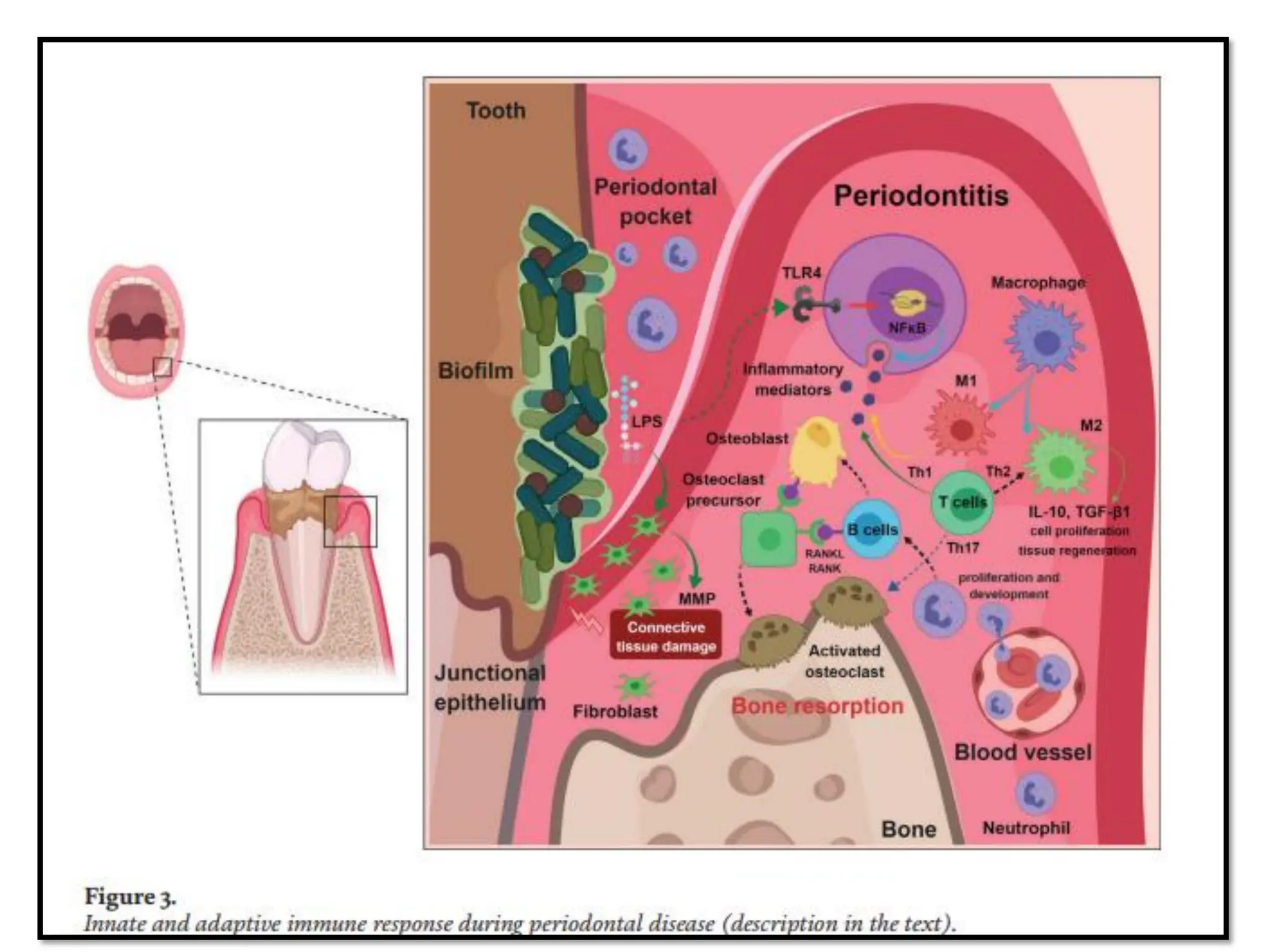 pathogenesis-of-periodontal.pdf