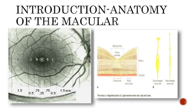 Pathogenesis and management of macular holes with video demonstration.pptx