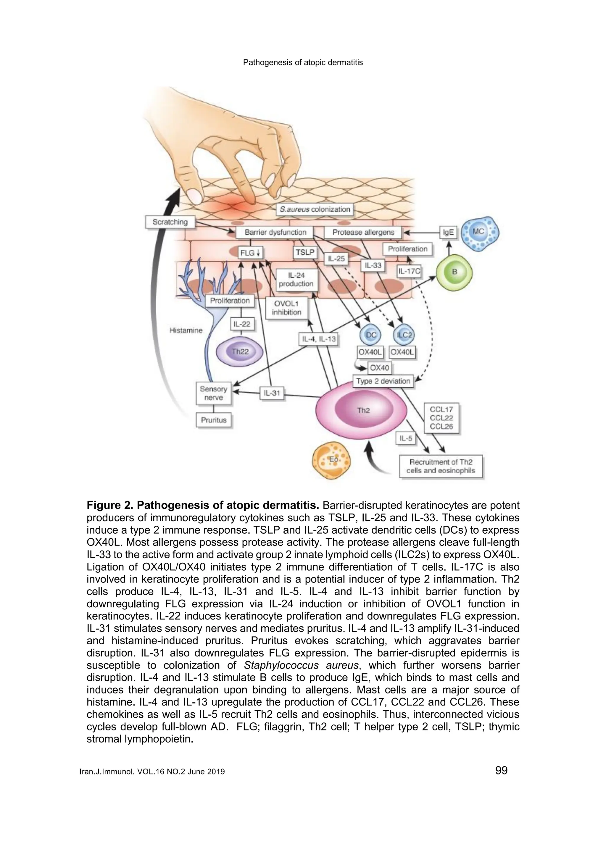 pathogenesis dermatitis atopik.pdf