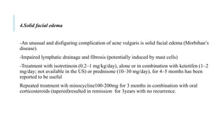 PATHOGENESIS OF ACNE VULGARIS- HORMONALS | PPTX