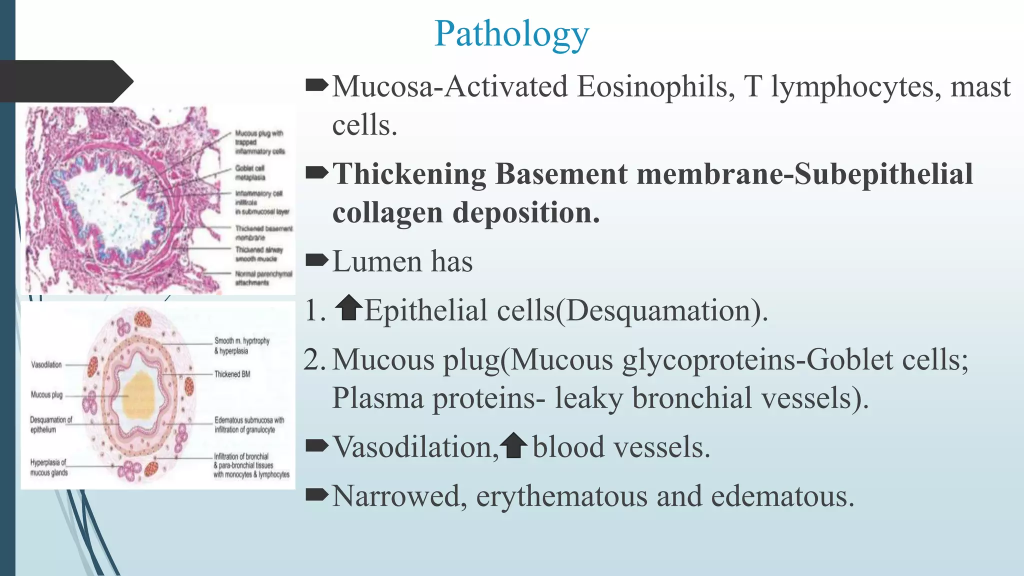 Pathogenesis of asthma | PPTX