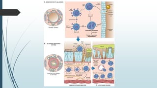 Pathogenesis of asthma | PPT