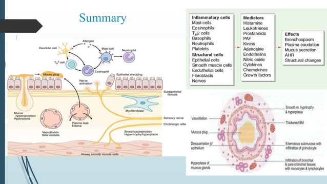 Pathogenesis of asthma | PPT