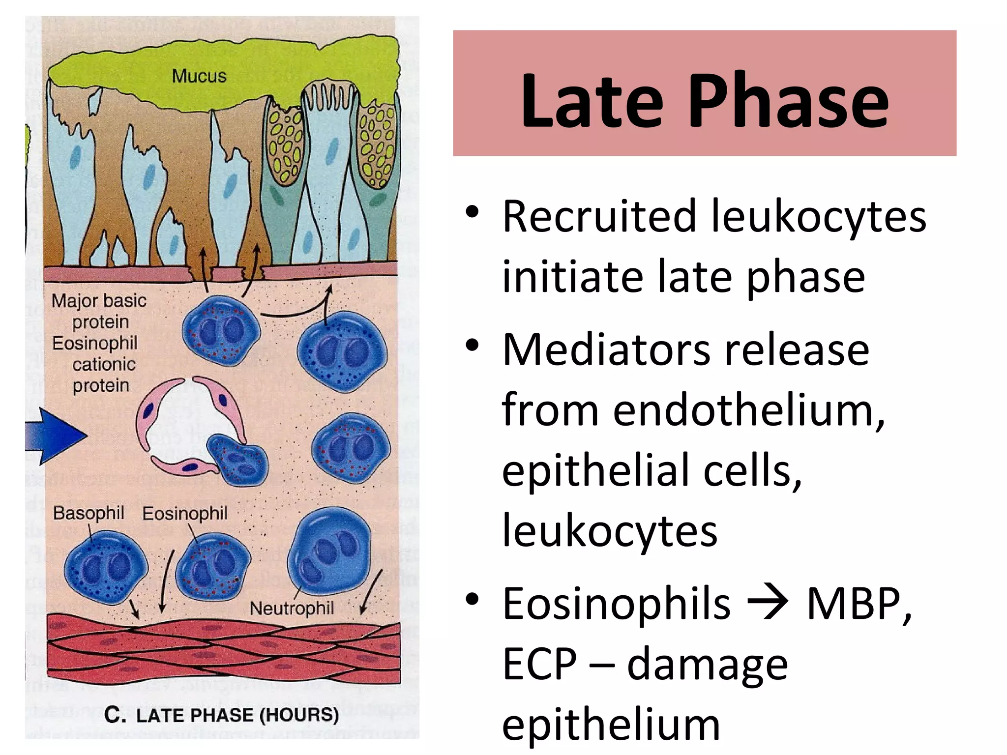 Pathogenesis of bronchial asthma | PPT