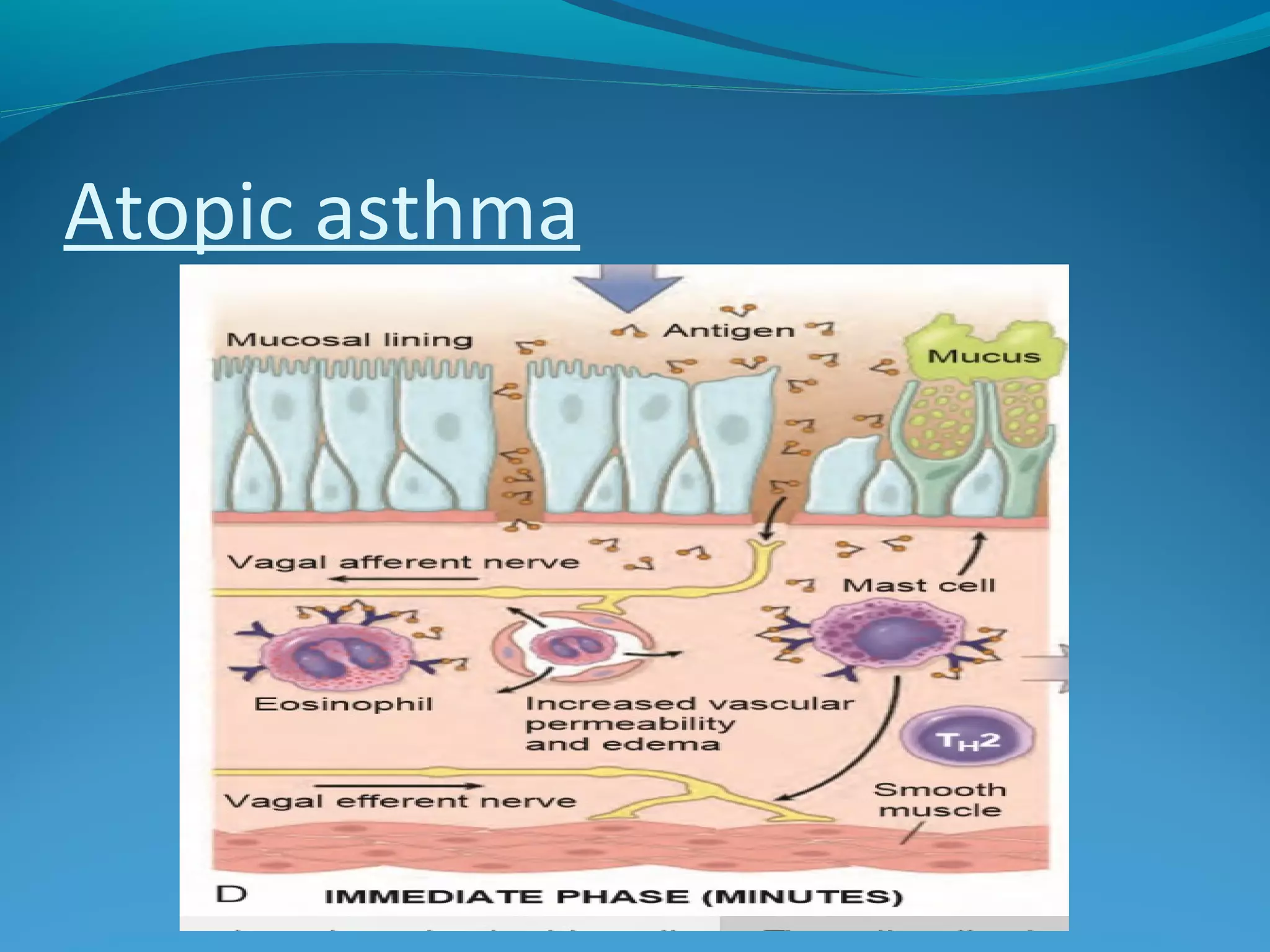 Pathogenesis of bronchial asthma | PPT