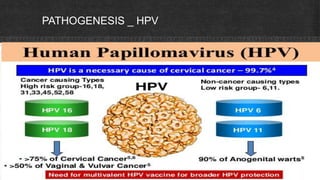 Pathogenesis of carcinoma cervix | PPTX