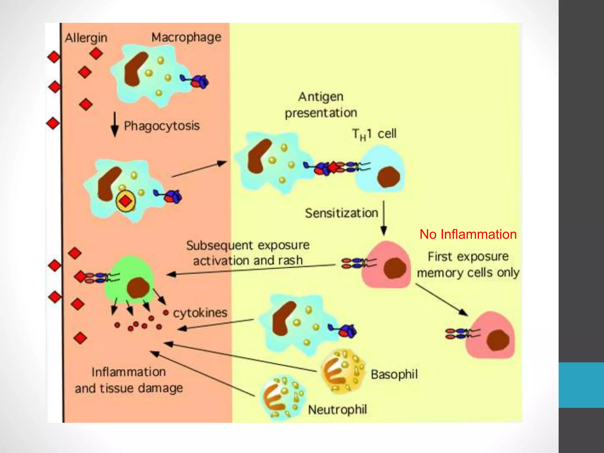 Pathogenesis of contact stomatitis | PPTX