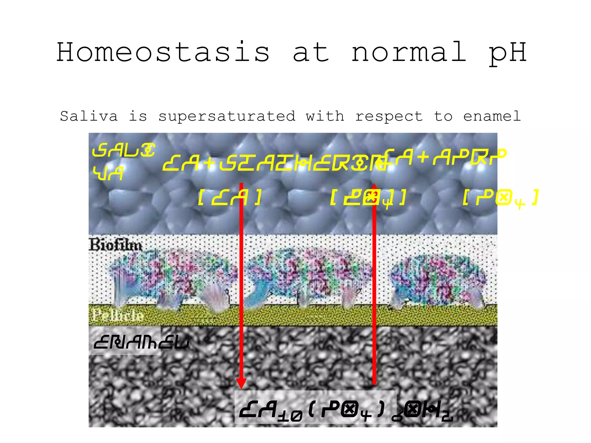 Pathogenesis of dental caries | PPSX