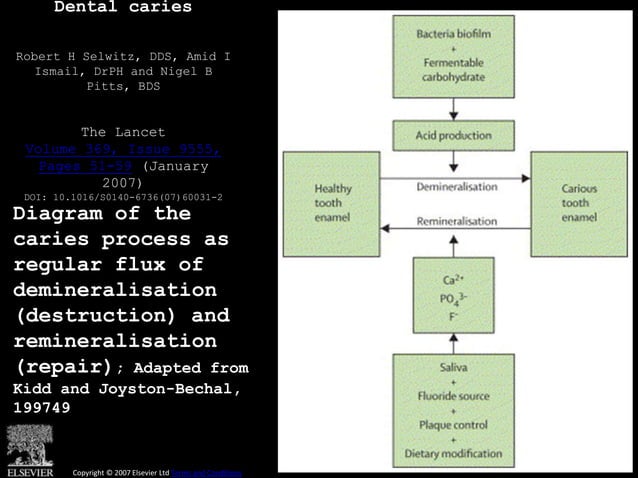 Pathogenesis of dental caries | PPSX | Dental Health | Diseases and ...