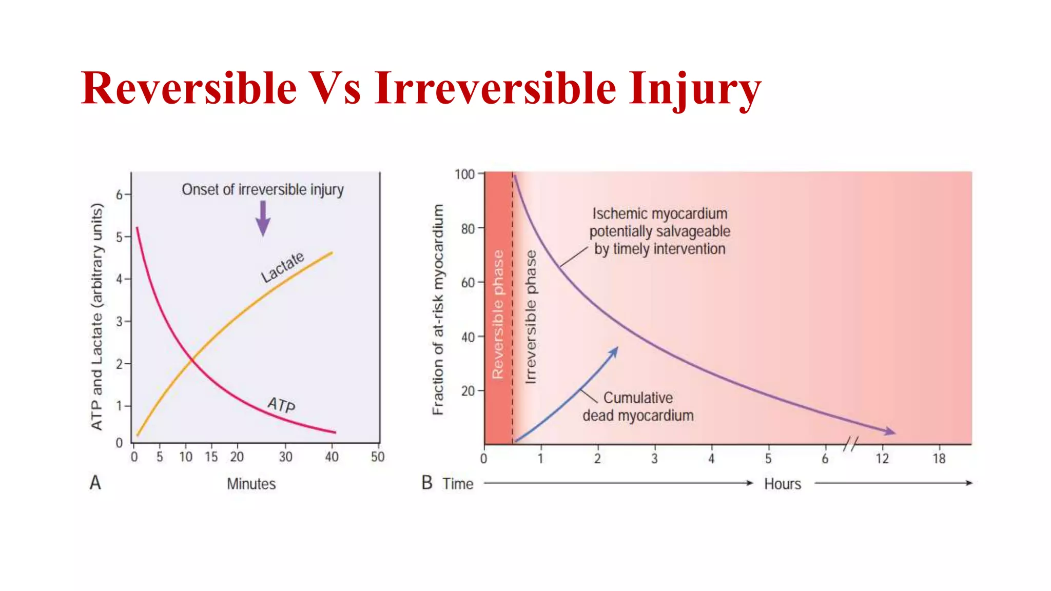 Ischemic heart disease | PPTX