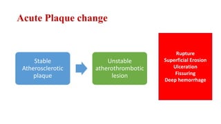 Ischemic heart disease | PPTX