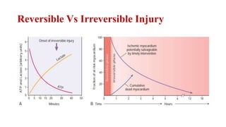 Ischemic heart disease | PPTX