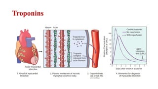 Ischemic heart disease | PPTX