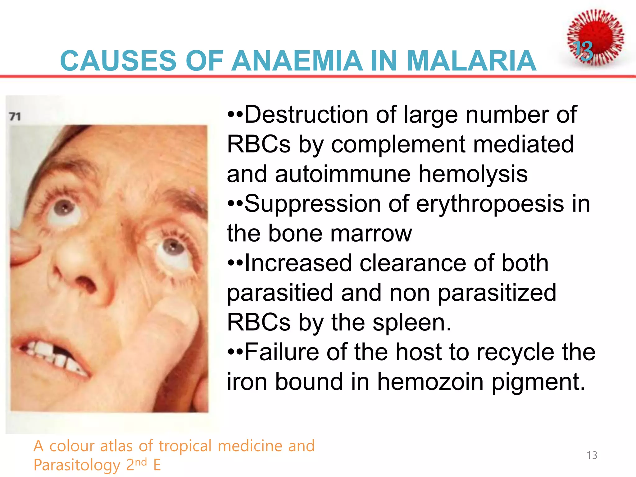 Pathogenesis of malaria | PPTX
