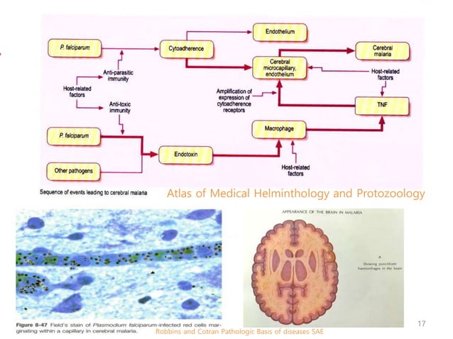 Pathogenesis of malaria | PPTX