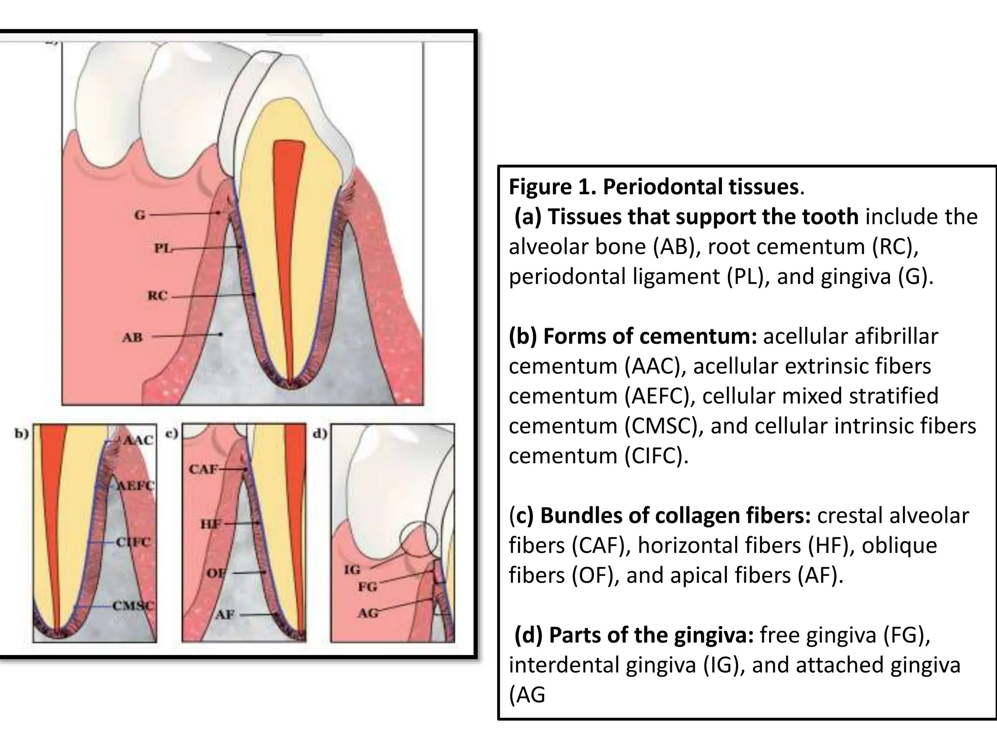 pathogenesis of periodontal.pptx
